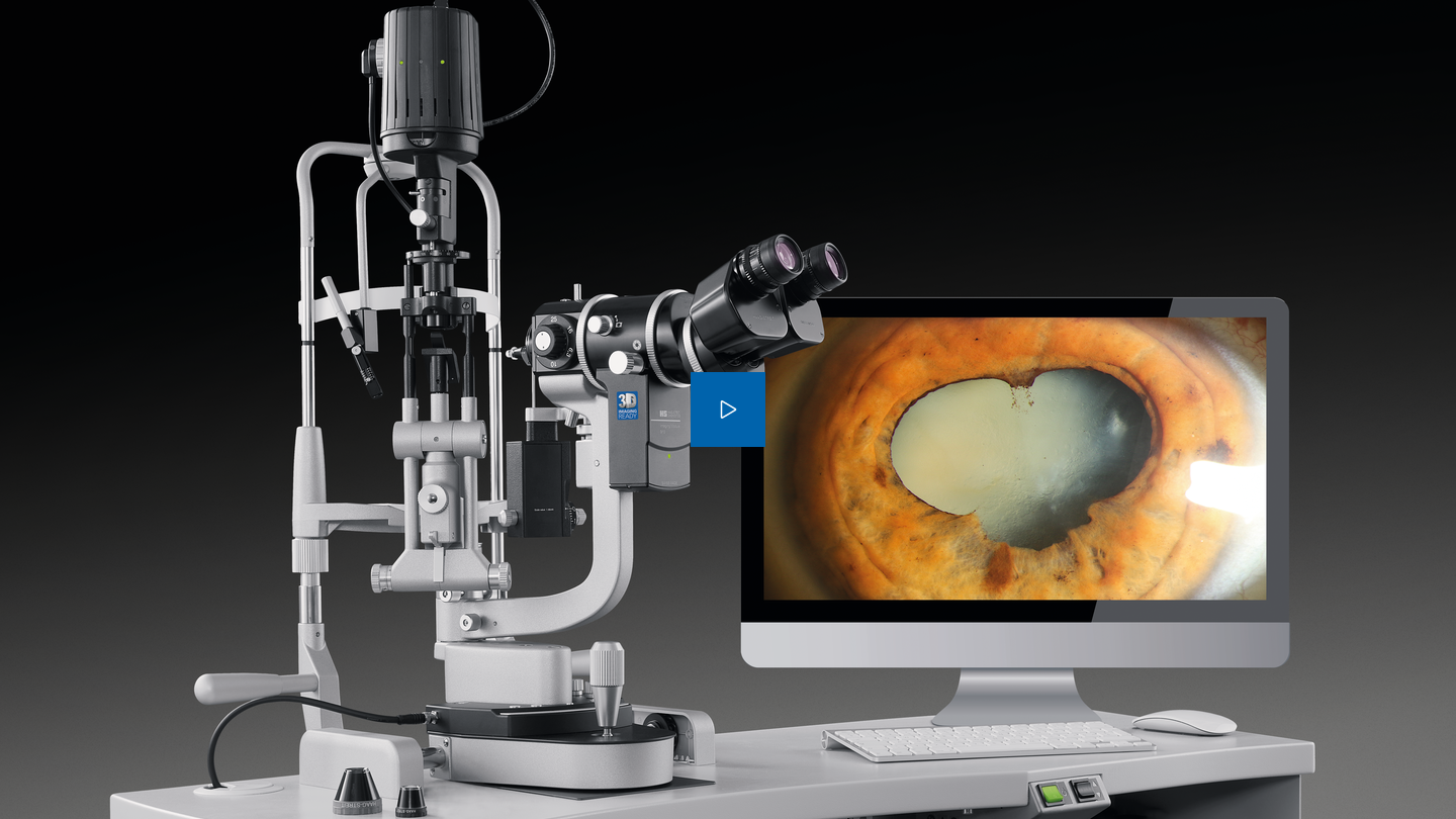 Slit lamp imaging